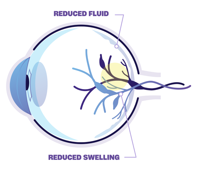 What is VABYSMO® (faricimab-svoa)?